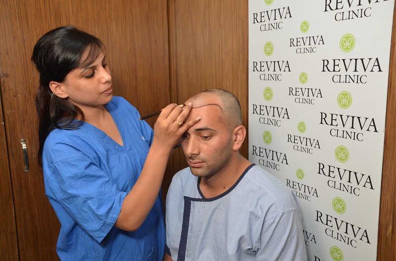 11 - Best Hair Transplant in India@Chandigarh, Reviva Clinic